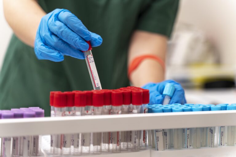 Lab Tests and Home Sample Collection – Iyashi Clinics
